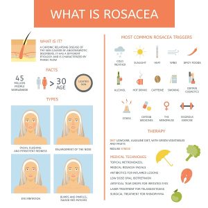Rosacea Causes & Risk Factors - DiseaseFix
