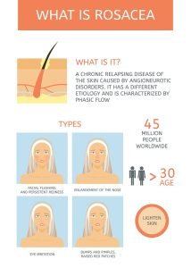 Rosacea Types, Symptoms & Treatment - DiseaseFix