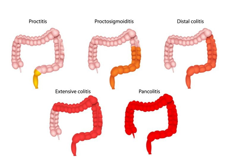 Comprehensive Guide to Urological Conditions | DiseaseFix