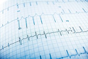 Need and Types of ECG (Electrocardiogram) - DiseaseFix