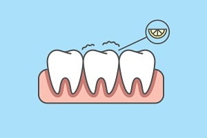 Causes of Sudden Tooth Sensitivity - DiseaseFix